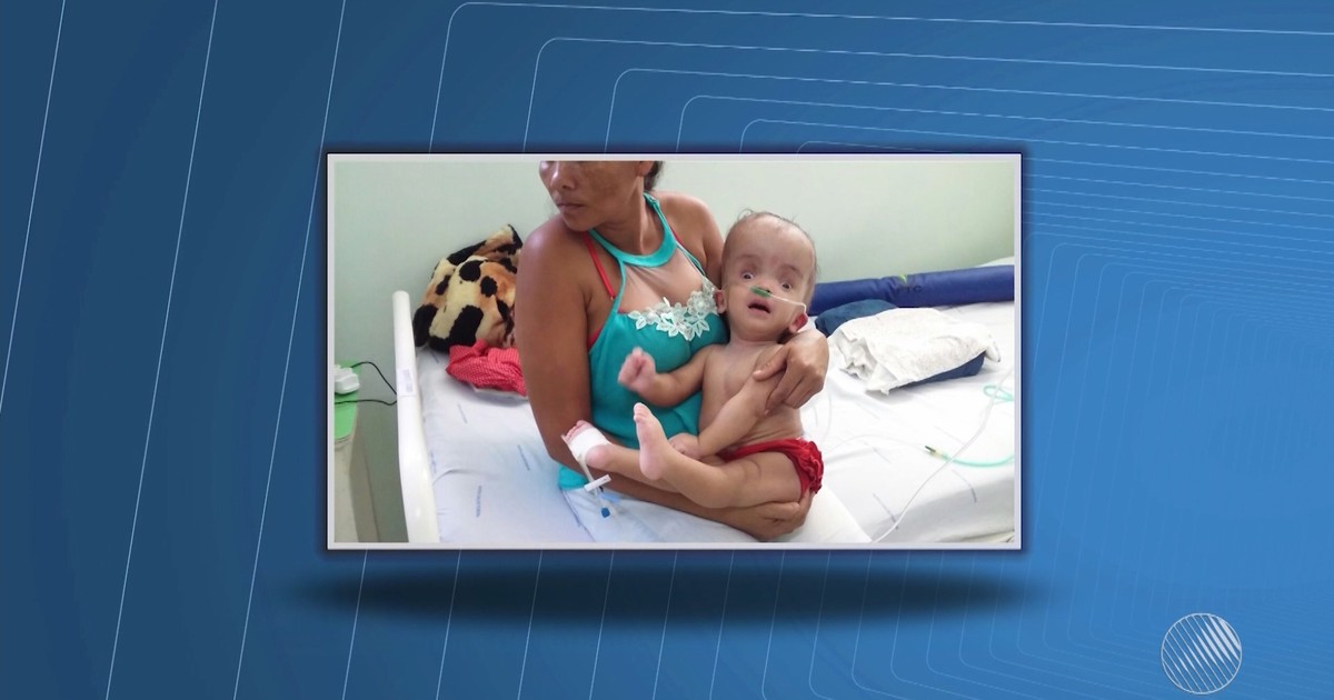 G1 - Bebê com hidrocefalia e meningite espera por cirurgia há 4 meses ...