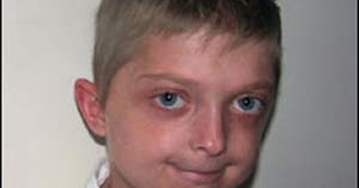 G1 - Doença rara faz menino de 11 anos envelhecer 5 vezes mais rápido ... G1 - Doença rara faz menino de 11 anos envelhecer 5 vezes mais rápido ...