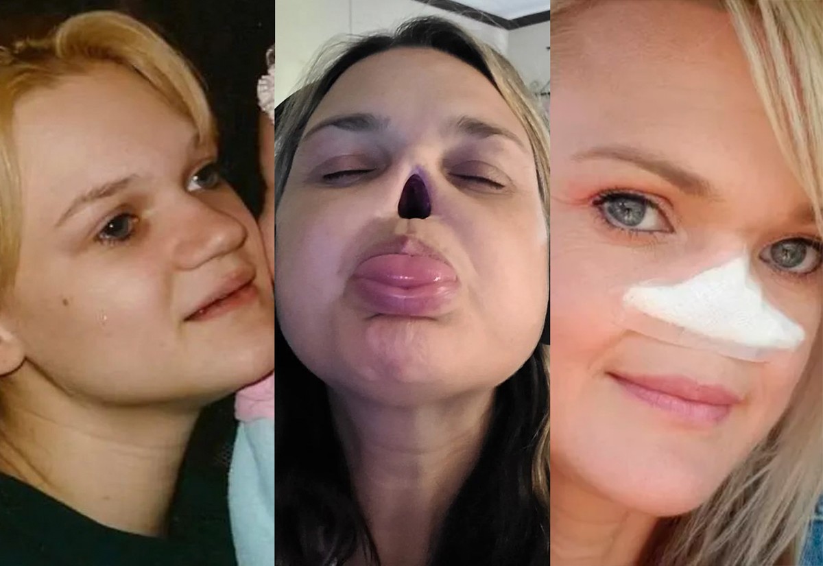 Influencer viraliza nas redes mostrando história de superação após ...