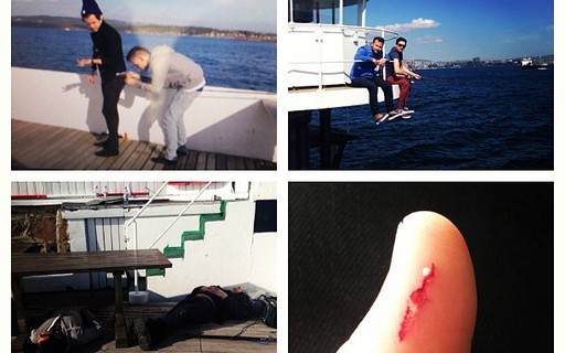 Harry Styles corta o dedo e mostra machucado aos fãs: "Dia duro" - Quem ...