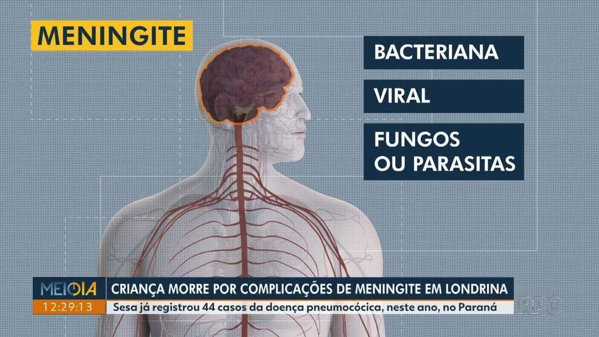 Criança morre por complicações de meningite em Londrina; saiba como ...