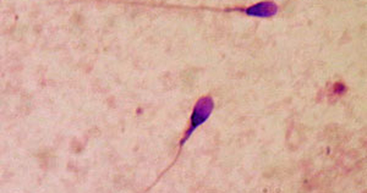 G1 - Cientistas sequenciam genes de espermatozoide pela primeira vez ...