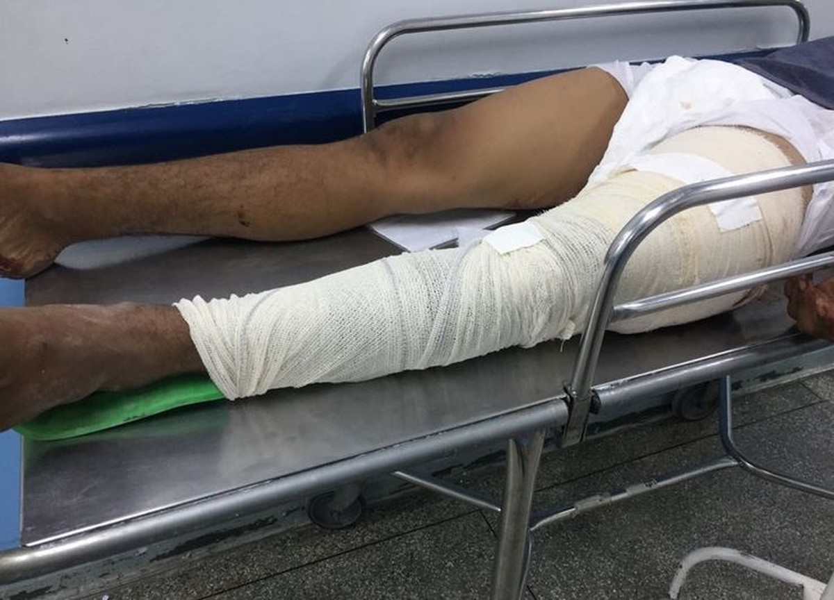 Ex Presidiário é Baleado Em Troca De Tiros Com Policiais Em Manaus