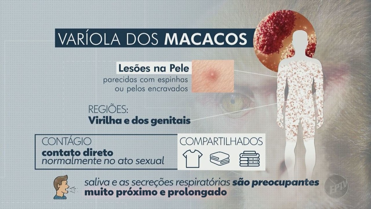 Em seis dias, casos de varíola dos macacos dobram na região de Campinas ...