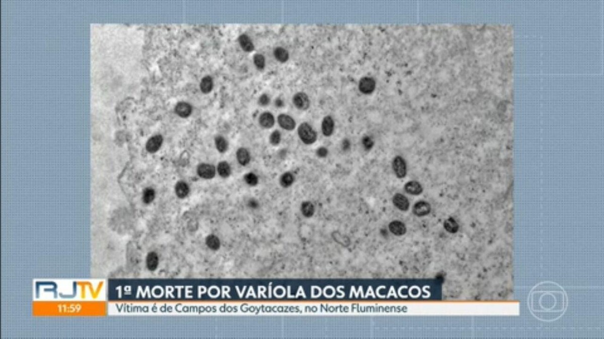 RJ confirma primeira morte por varíola dos macacos no estado | Rio de ...
