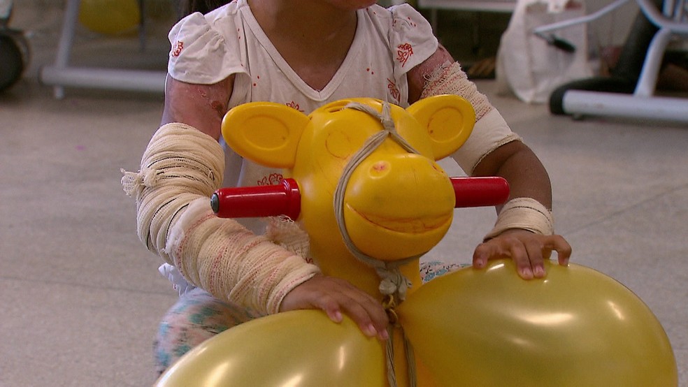Sobe o número de queimados por fogos de artifício durante festas de fim ...