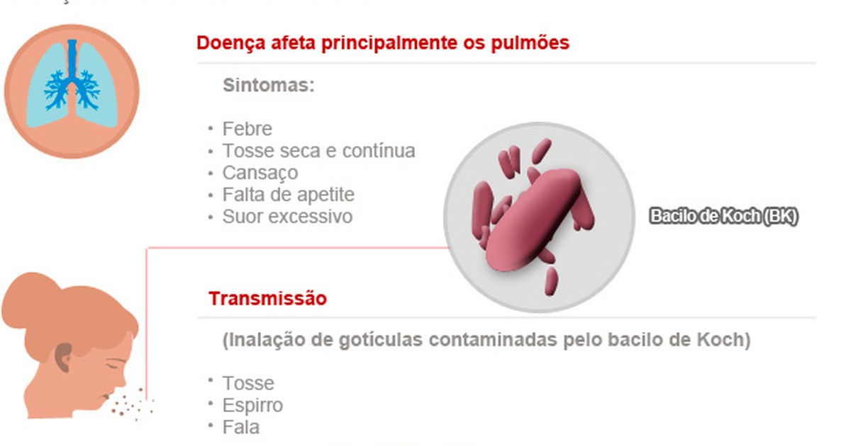 G1 - Após novos exames, 13 bebês apresentam bacilo da tuberculose ...