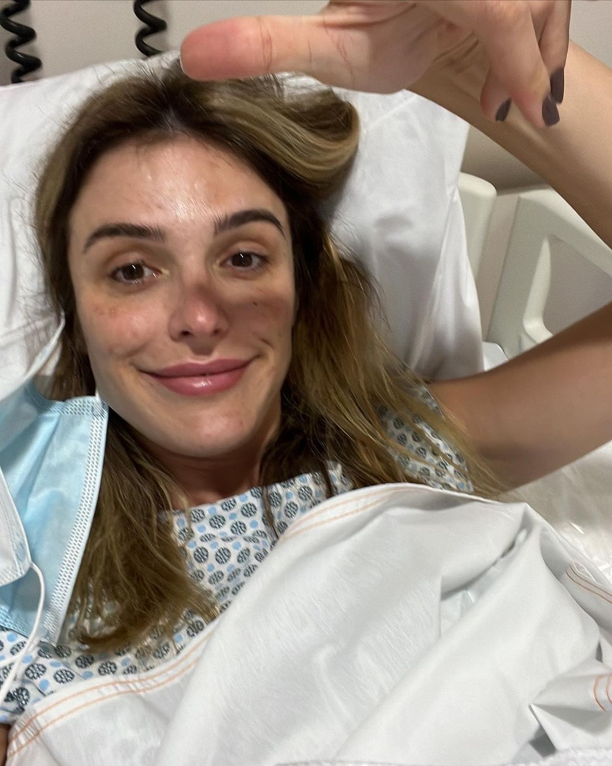 Rafa Brites dá detalhes das 3 cirurgias realizadas que impossibilitavam ...