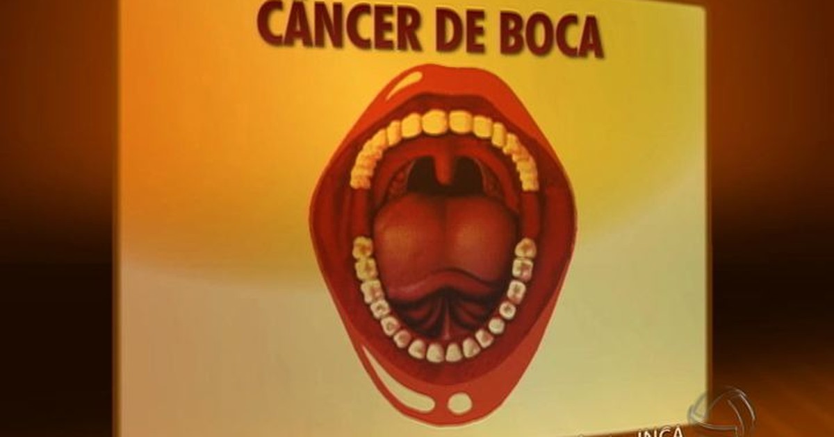 G1 - Médicos fazem campanha de prevenção ao câncer de boca em MS ...