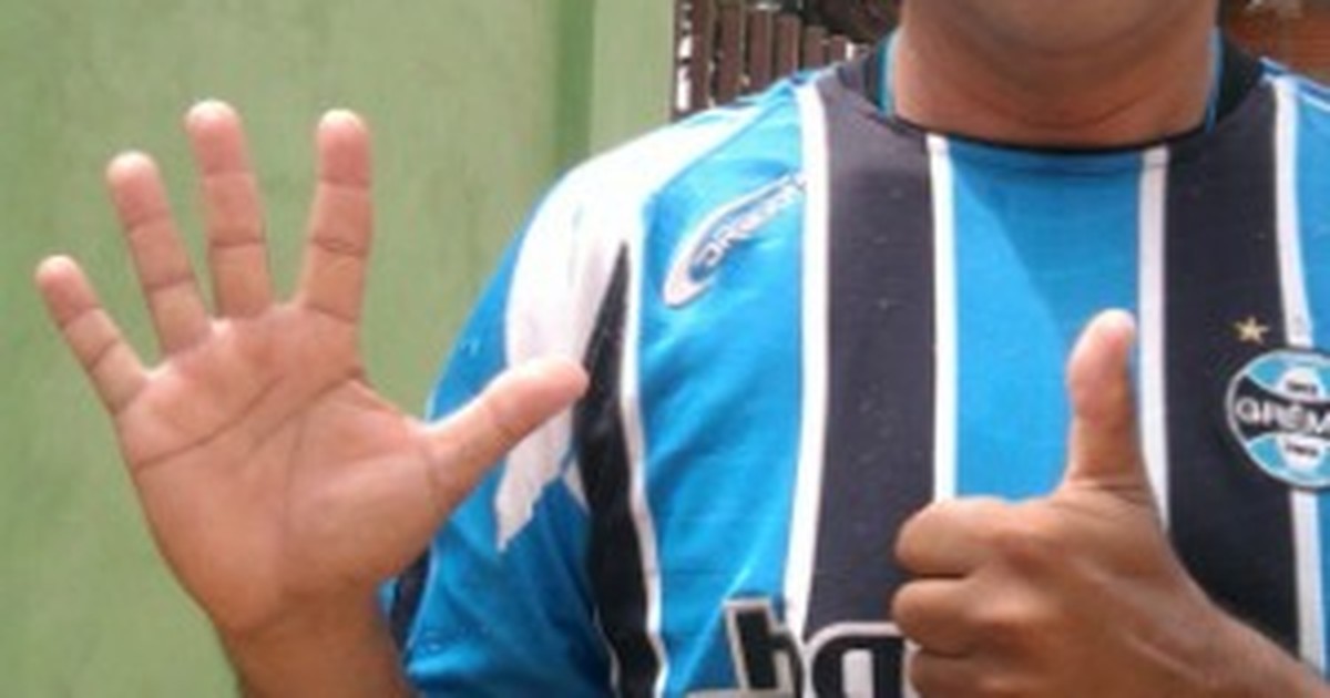 G1 - 'Vou soltar, mas com cuidado', diz homem queimado por fogos em ...