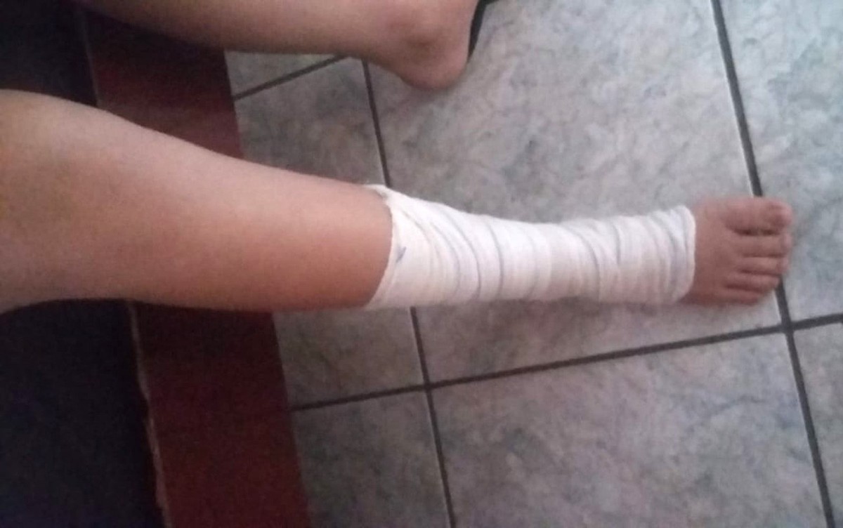 Adolescente fica ferida ao ser 'atropelada' por roda que escapou de carro em Franca | Ribeirão ...