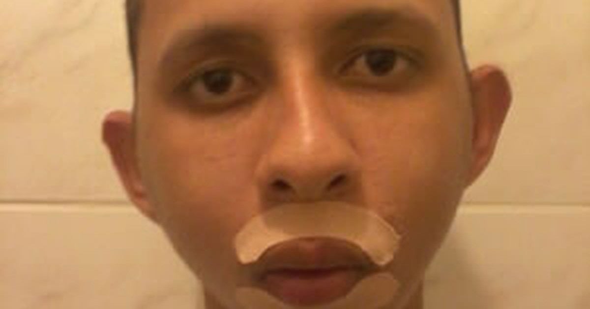 G1 - Jovem sem queixo faz cirurgia em MT e diz: 'sempre sonhei em comer ...