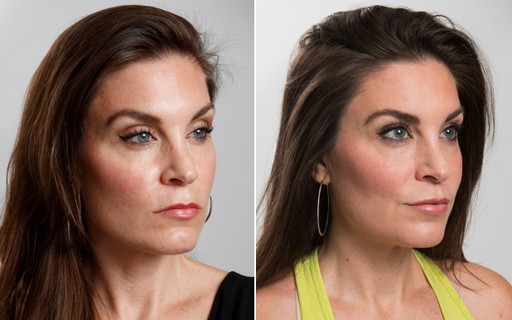 Mulheres fazem cirurgias plásticas para "consertar cara de brava ...