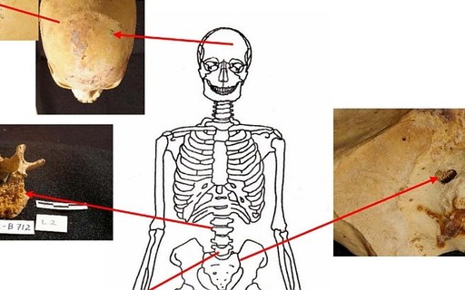 Pesquisadores encontram câncer em múmia egípcia de quase 3 mil anos ...