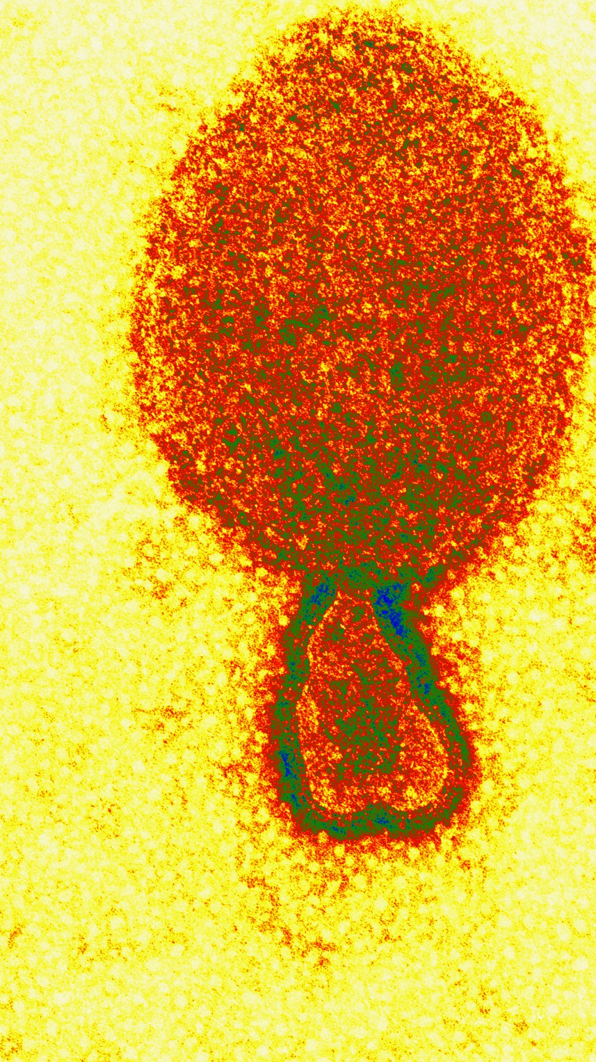 Langya henipavirus: o que se sabe sobre o novo vírus identificado na ... Langya henipavirus: o que se sabe sobre o novo vírus identificado na ...