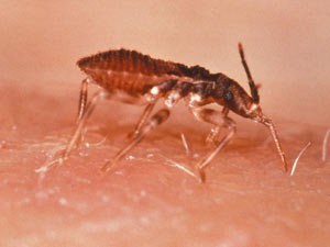 G1 - Novos casos de Doença de Chagas no Brasil se concentram no Pará e ...