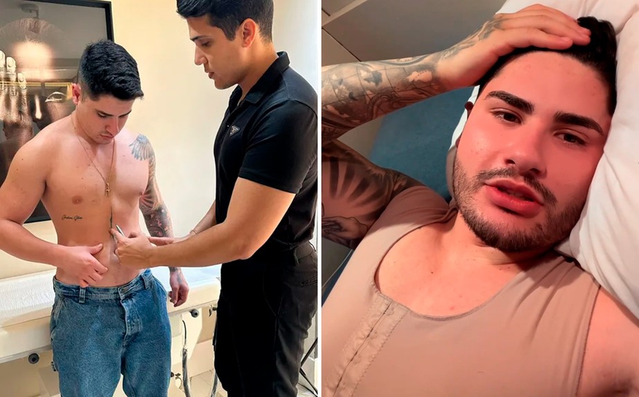 Lucas Souza, ex de Jojo, passa por lipo HD para ganhar tanquinho
