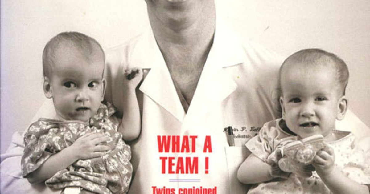 Bem Estar - Médico reencontra gêmeas siamesas separadas em cirurgia 18 ...