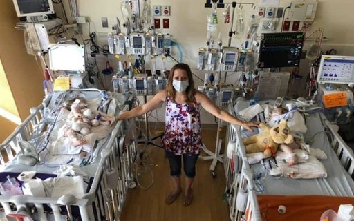 Pais se preparam para cirurgia de separação de siamesas recém-nascidas ...