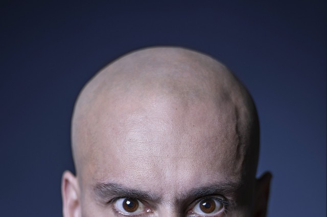 Alexandre Nero surge careca para personagem com câncer em filme ...