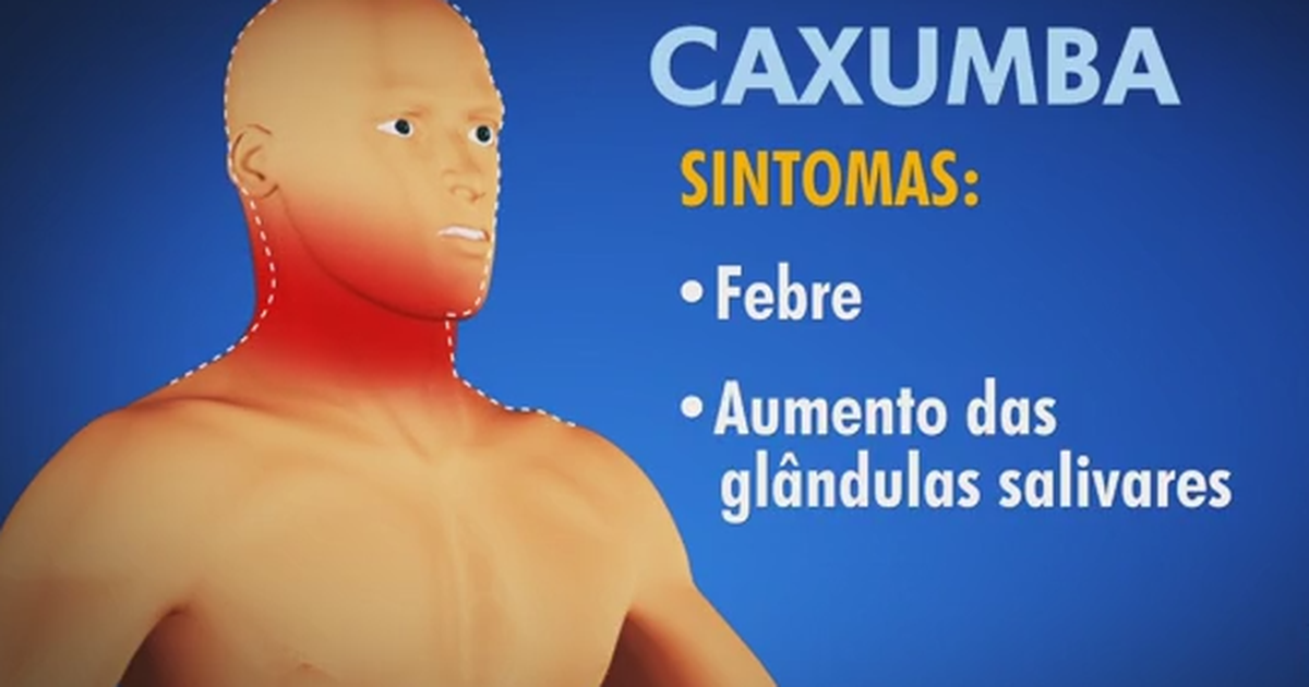 G1 - Santos registra aumento de 490% em casos de caxumba; saiba ...