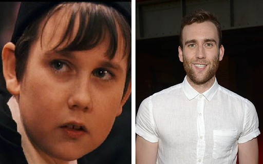 Ator explica por que é doloroso rever sua atuação em filmes de 'Harry ...