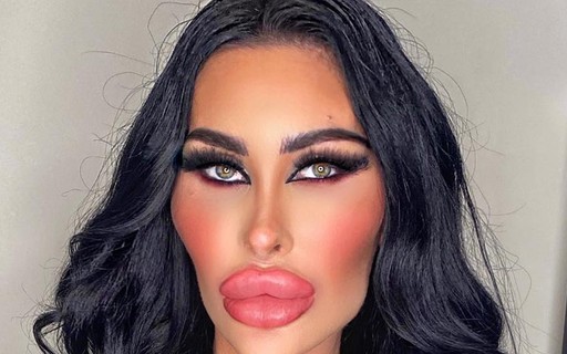 'Barbie humana' australiana já gastou mais de R$ 1 milhão em plásticas ...