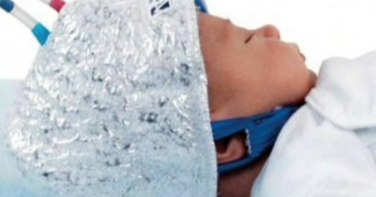 Bom Dia Brasil - Técnica de congelamento do corpo ajuda a salvar vidas ...