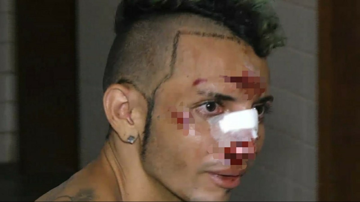 Homem é Agredido Por Moradores Após Tentar Assaltar Duas Pessoas Com