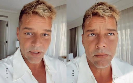 Ricky Martin nega procedimentos no rosto após críticas: "Inchado ...
