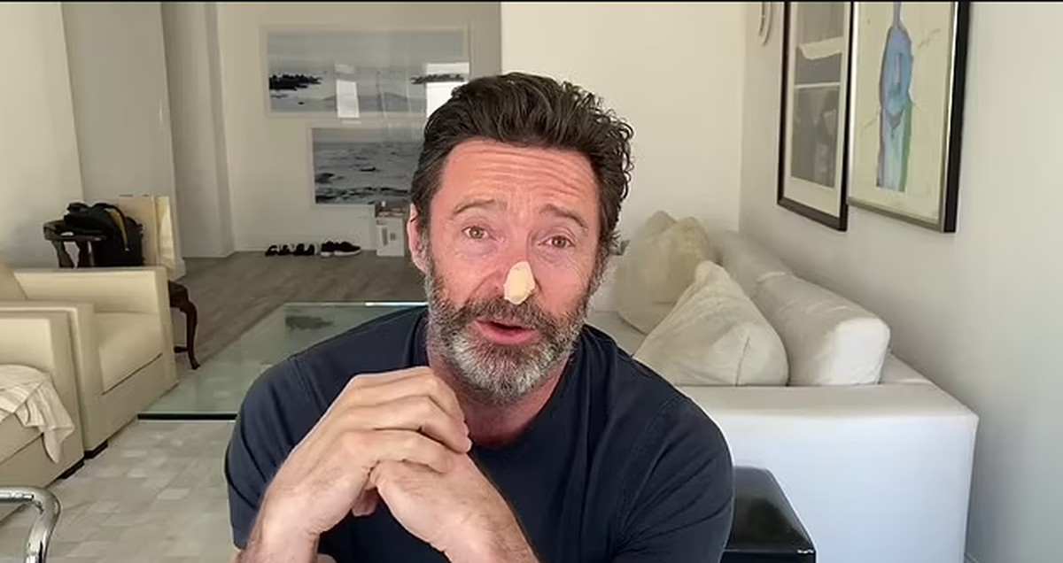 Hugh Jackman, o Wolverine, faz biópsias por suspeita de novo câncer de ...