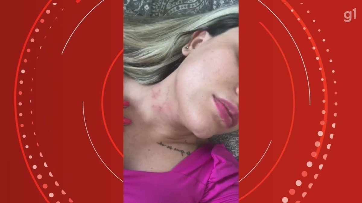 Mulher Gravou Marcas De Agressão E Denunciou Ex Companheiro Pm 1 Mês