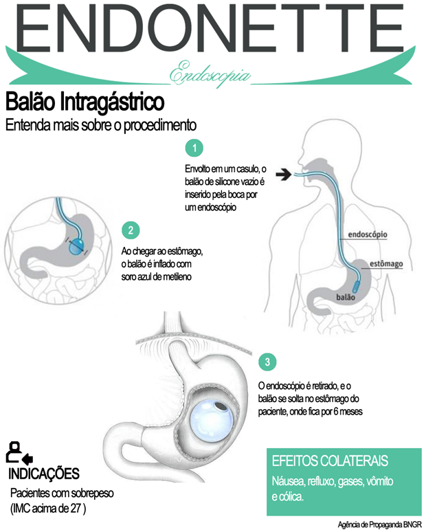 G1 - Clínica Endonette: Pioneira em tratamento contra obesidade ...