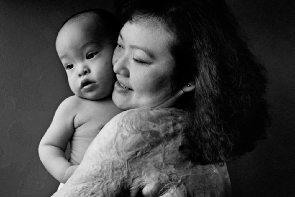 'Garota Napalm': Como está a menina da foto que virou símbolo da Guerra do Vietnã, há 50 anos