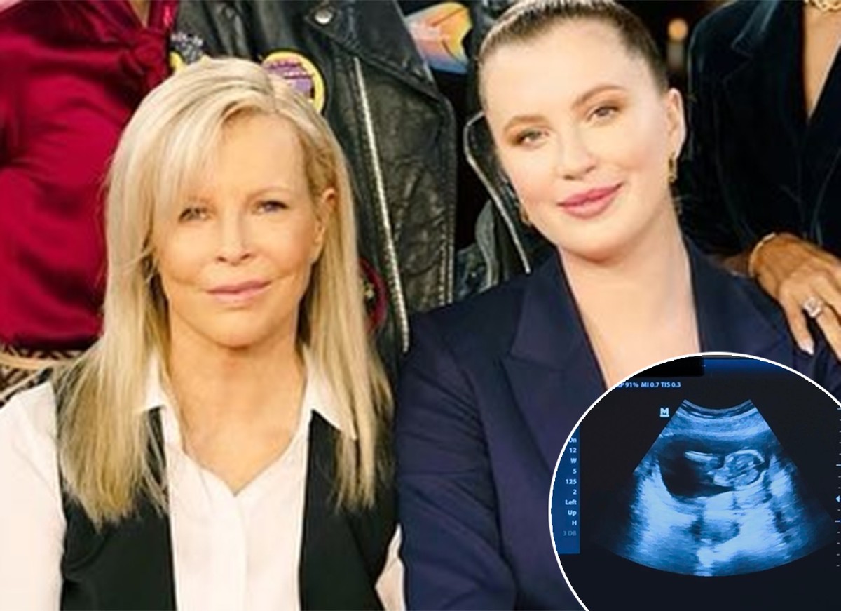 Kim Basinger mostra ultrassom e entrega sexo do bebê da filha, Ireland ...