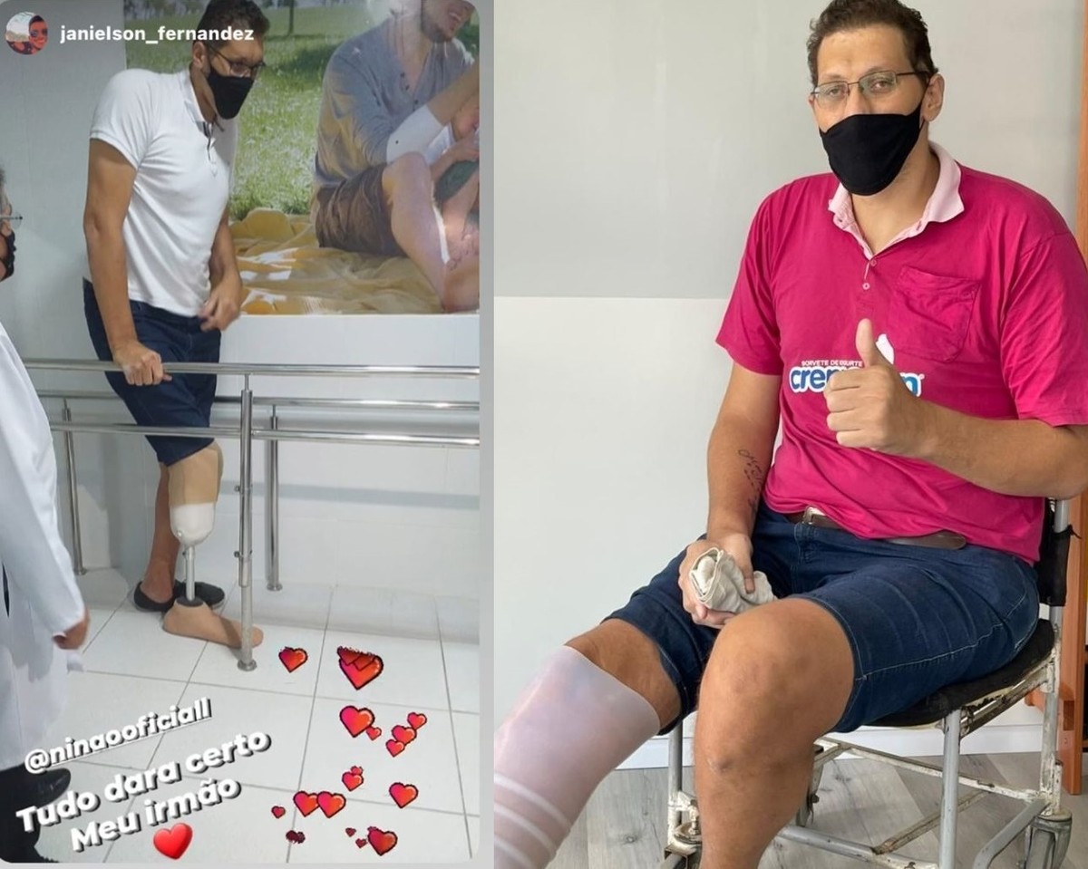 Homem mais alto do Brasil faz primeira prova de prótese da perna e ...