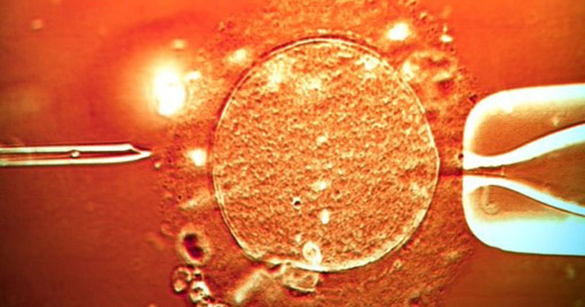 G1 - Anvisa altera regras para bancos de embriões no Brasil - notícias ...