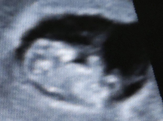 Natureza - Zoo anuncia gravidez de elefanta e mostra imagens de ultrassom