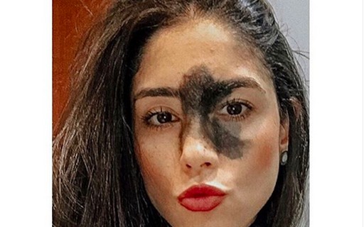 Modelo brasileira com marca de nascença no rosto quer usar fama mundial ...