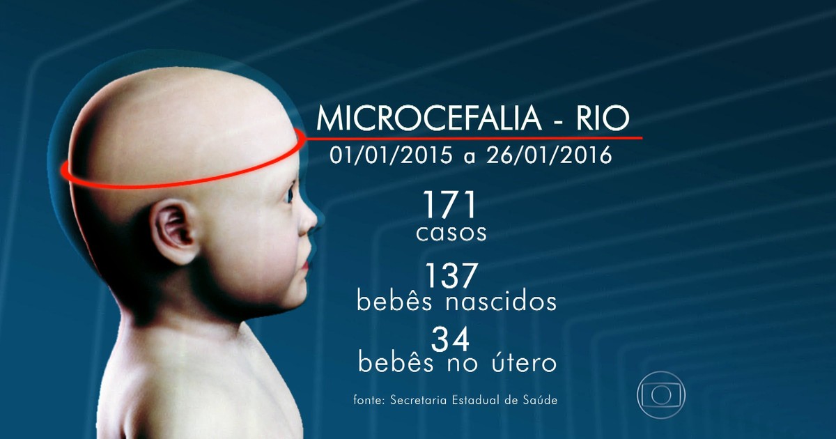G1 - Número de casos de microcefalia no estado do Rio passa de 170 ...