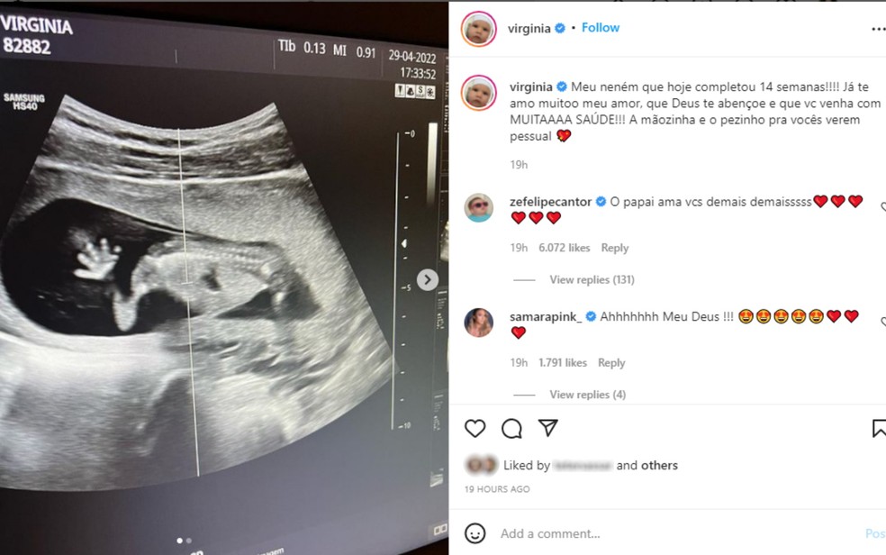 Bebê de Virginia Fonseca e Zé Felipe 'dá tchau' em ultrassom, e fãs ...
