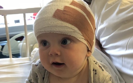 "A circunferência da cabeça é um indicador-chave", alerta mãe de menino ...