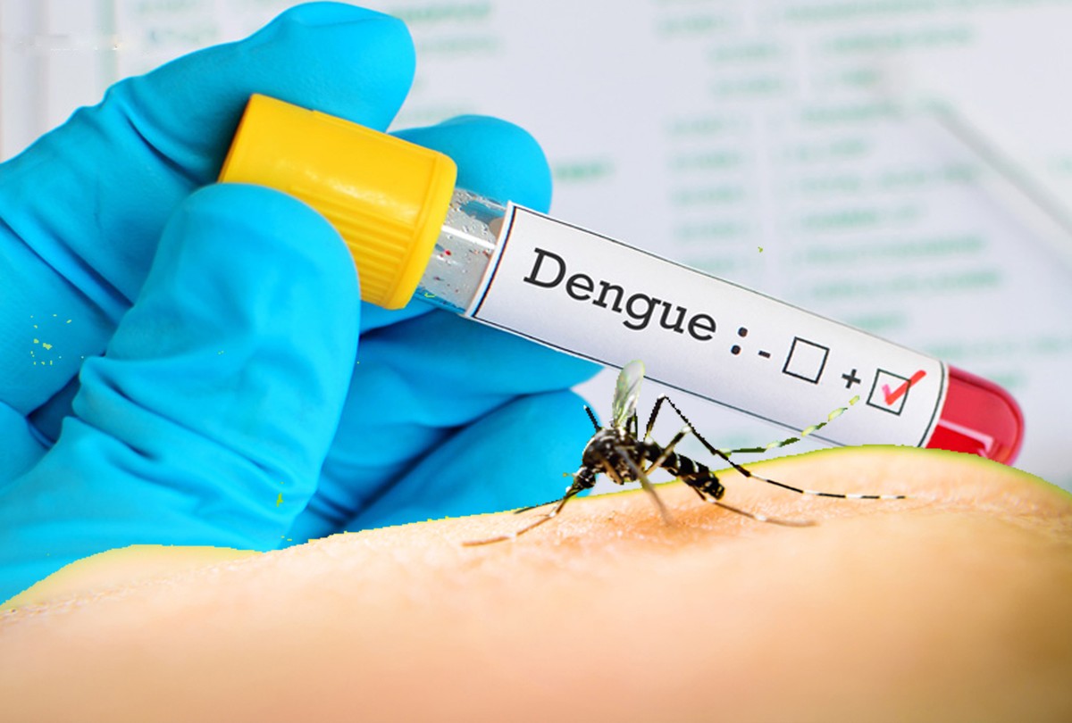 Com sete registros em julho, casos de dengue em Ribeirão Preto acumulam ...