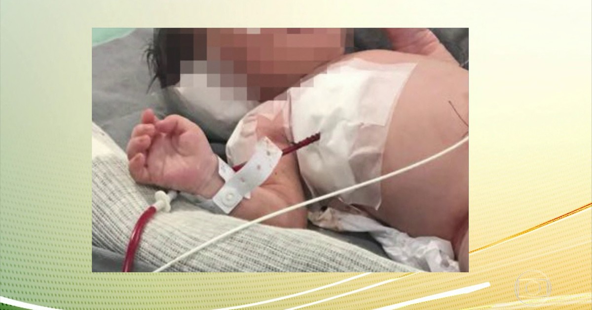 Jornal Hoje - Paralisia do bebê baleado na barriga da mãe no RJ pode ...