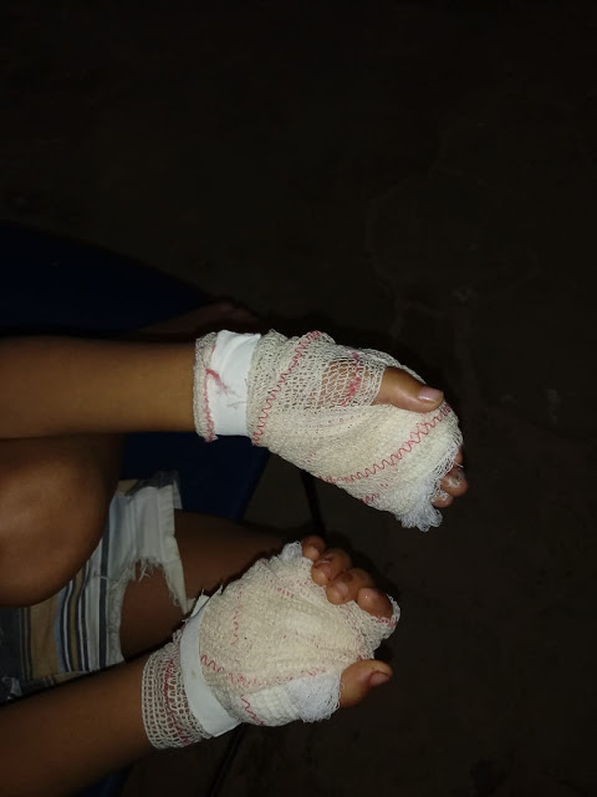 Mãe é Presa Após Torturar Filho De 4 Anos No Maranhão Maranhão G1
