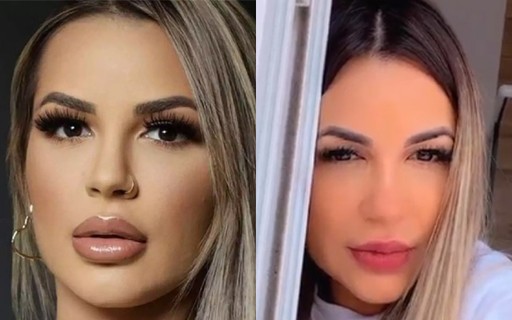 Deolane Bezerra retira preenchimento labial: "Boquinha"; compare - Quem ...
