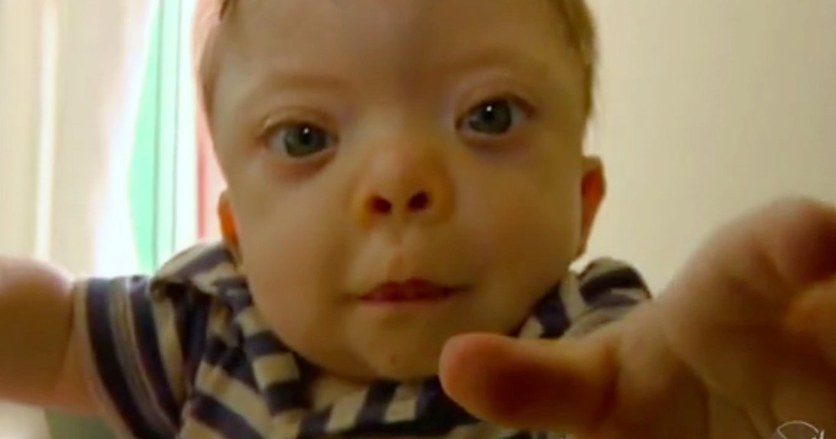 G1 - Campanha arrecada 100% do valor de cirurgia para bebê Bernardo nos ...