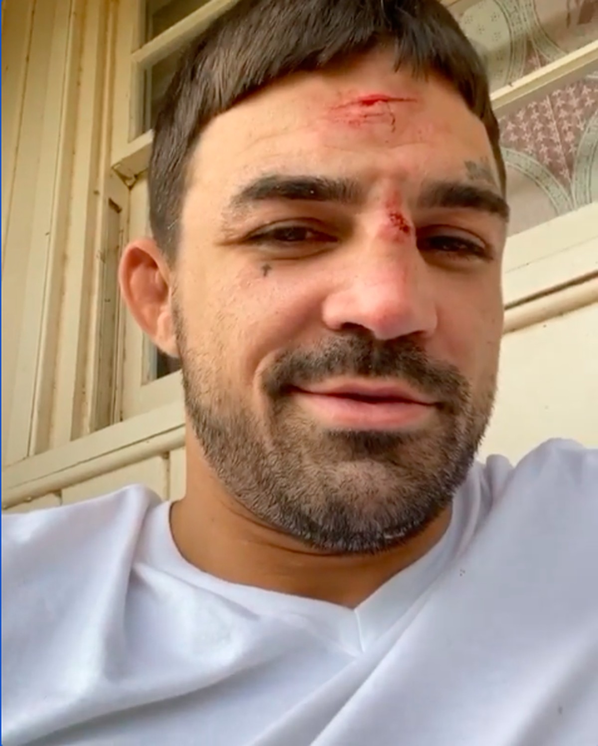 Com luta marcada para próxima semana, Mike Perry aparece com cortes na ...