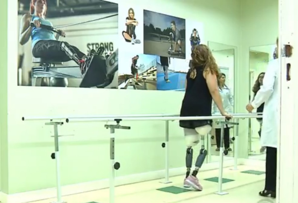 Estudante que teve pernas amputadas na infância consegue próteses após ...