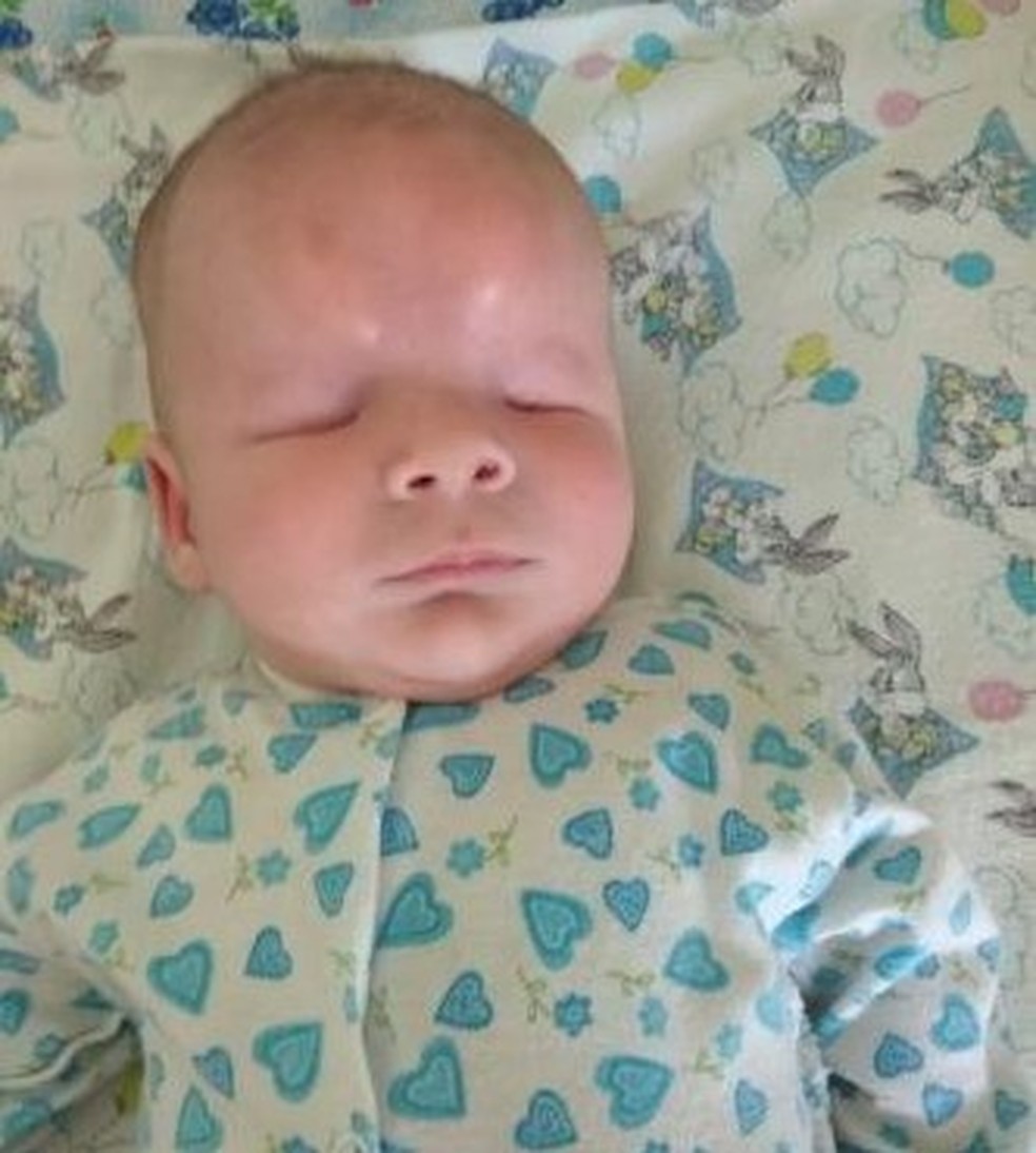 Bebê que nasceu sem os olhos aguarda adoção em orfanato russo | Mundo | G1